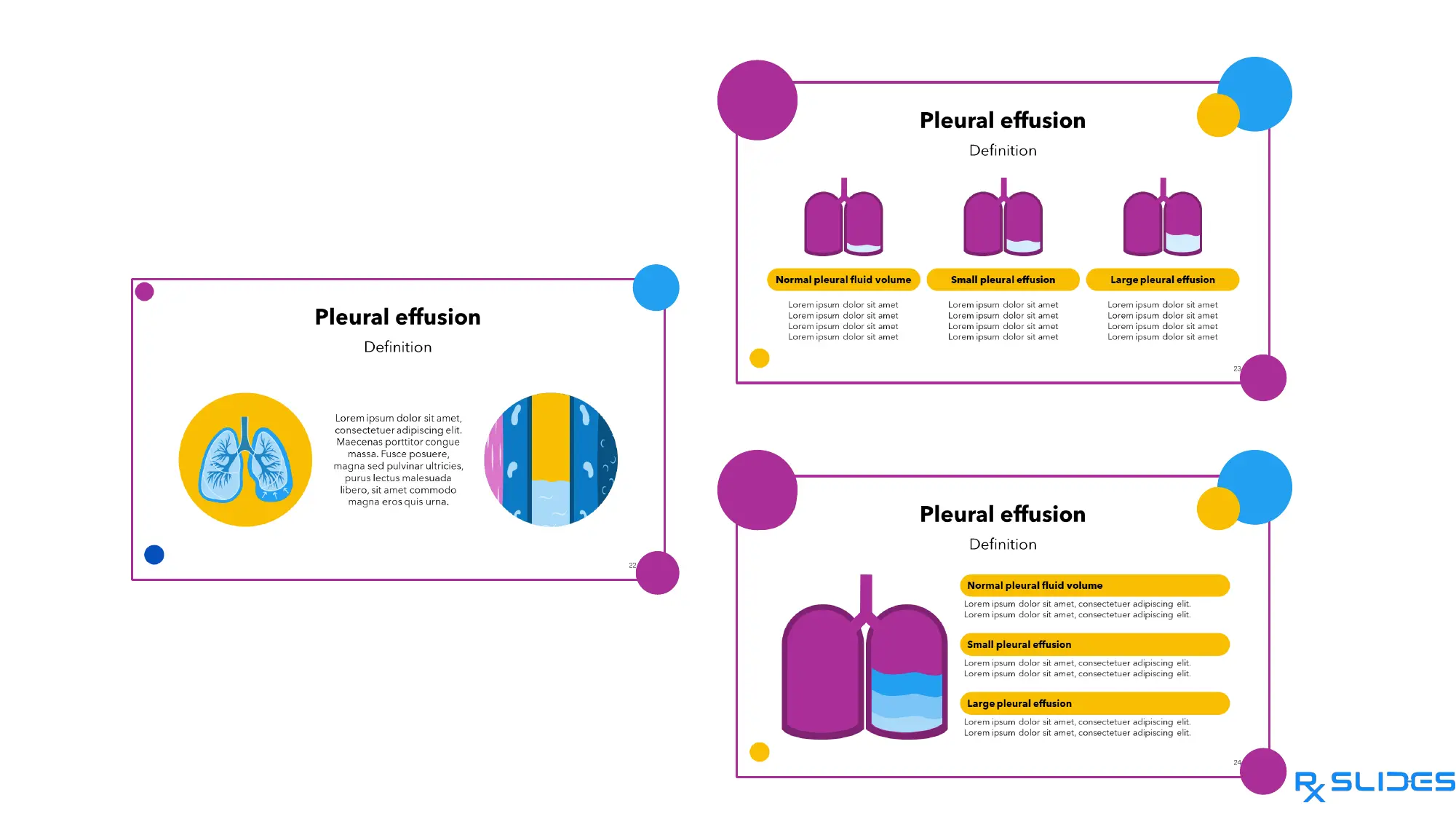 Download Pleural Effusion PowerPoint Template|RxSlides